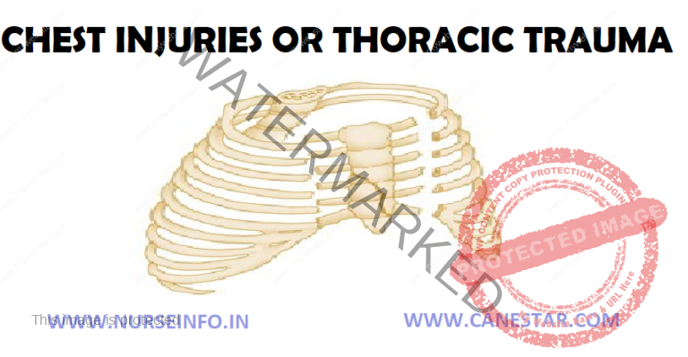 CHEST INJURIES - Nurse Info