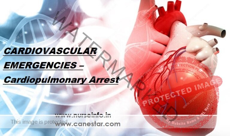 Cardiopulmonary Arrest | Nurse Info
