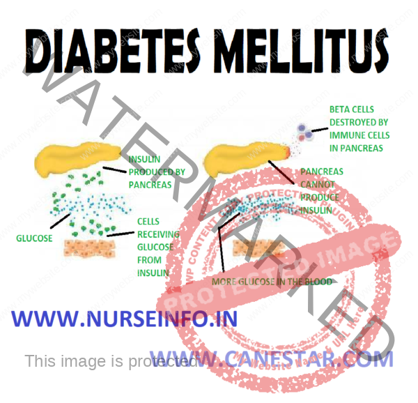 DIABETES MELLITUS - Nurse Info