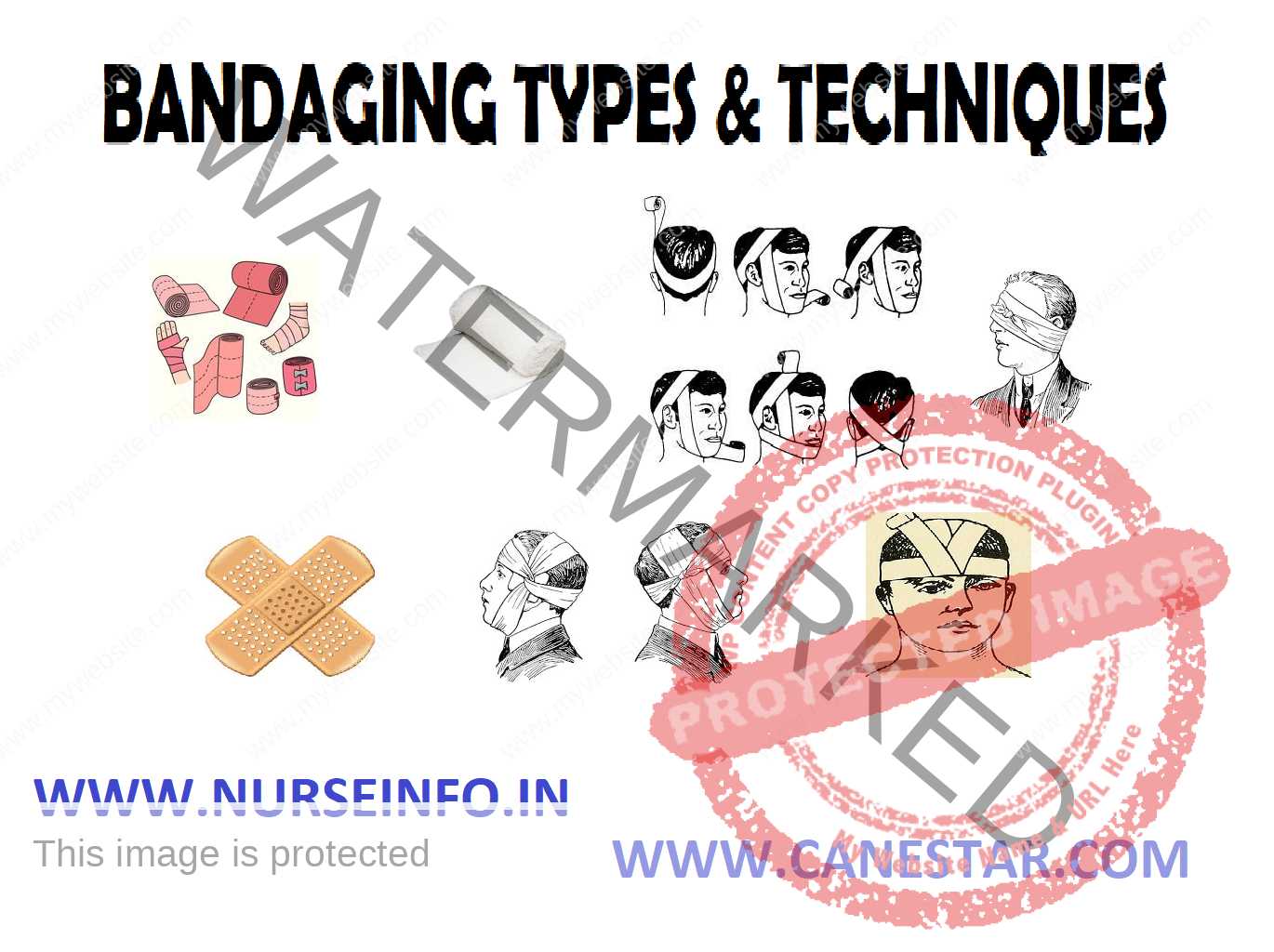 BANDAGING NURSING PROCEDURE Nurse Info BANDAGING NURSING PROCEDURE Nurse Info