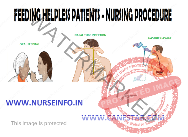 NURSING PROCEDURE - DIET FOR PATIENTS (Feeding the Helpless Patient ...