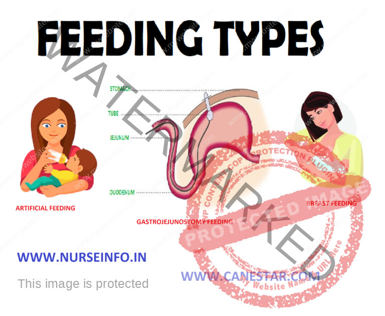 DIET FOR PATIENTS – FEEDING TYPES – NURSING PROCEDURE - Nurse Info DIET ...