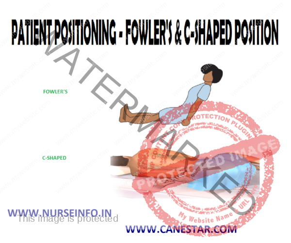 PATIENT POSITIONING – FOWLER’S & C-SHAPED POSITION - Nurse Info