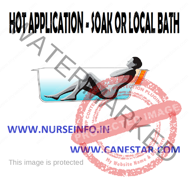 SOAK OR LOCAL BATH (Hot Application) - Nurse Info SOAK OR LOCAL BATH (Hot Application) - Nurse Info