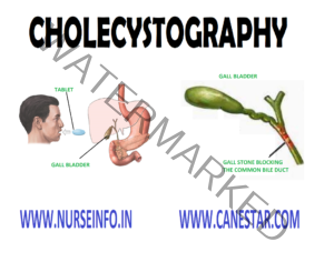 CHOLECYSTOGRAPHY - Nurse Info CHOLECYSTOGRAPHY – Purpose, Preparation ...
