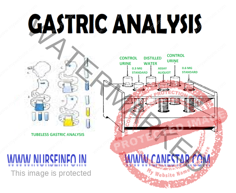 GASTRIC ANALYSIS - Nurse Info