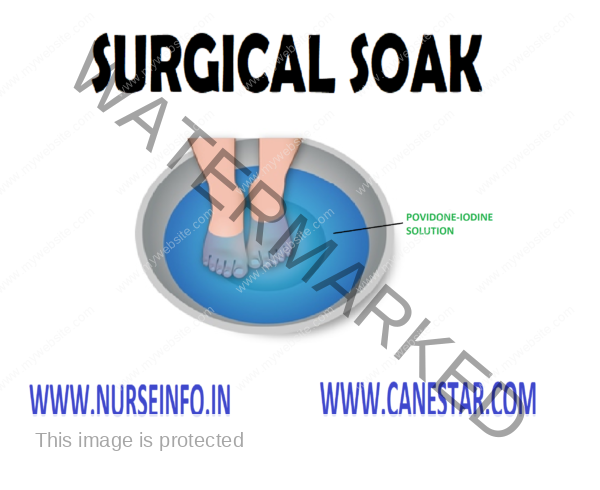 SURGICAL SOAK – Purpose, Preliminary Assessment, Preparation of the ...