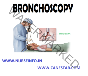 BRONCHOSCOPY - Nurse Info