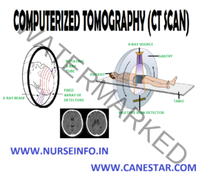 COMPUTERIZED TOMOGRAPHY - Nurse Info