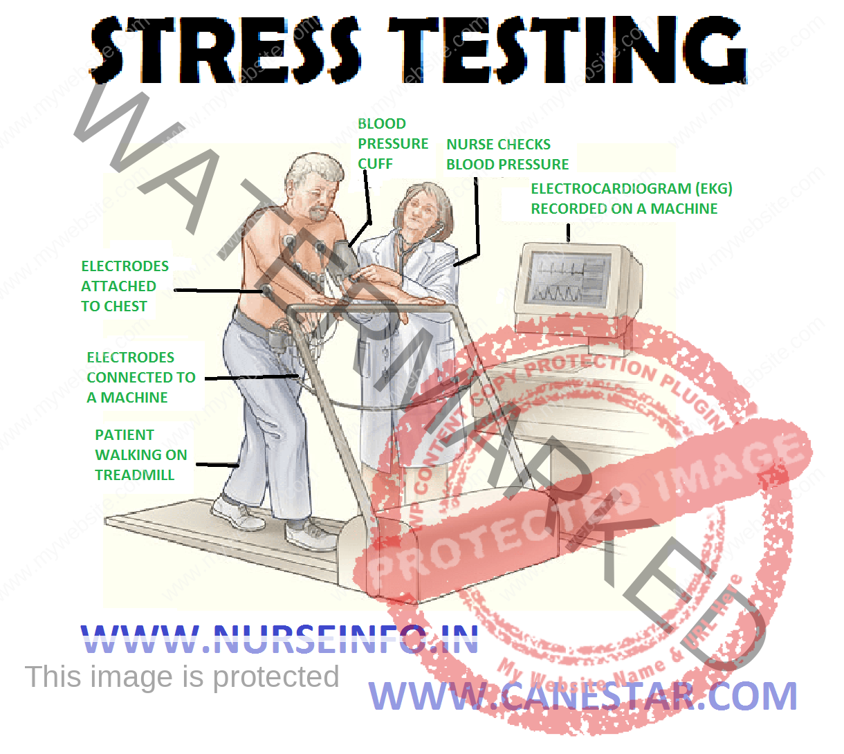 STRESS TESTING | Nurse Info