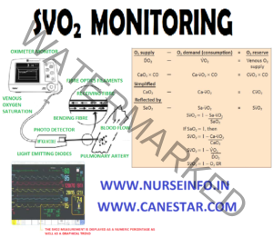 SvO2 MONITORING - Nurse Info