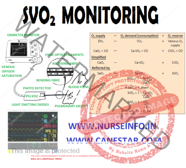 SvO2 MONITORING - Nurse Info