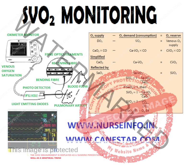 SvO2 MONITORING - Nurse Info
