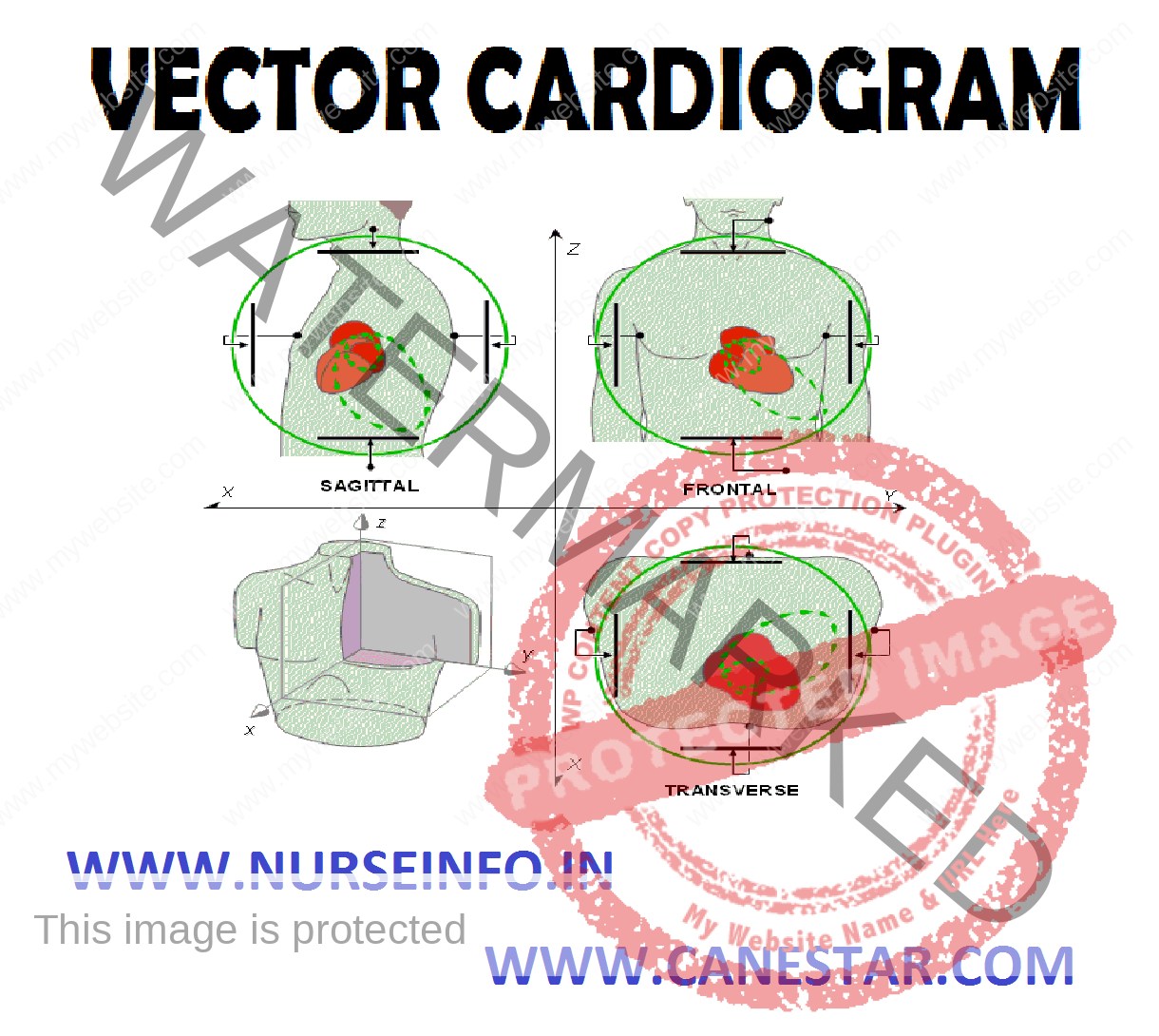 VECTORCARDIOGRAM - Nurse Info