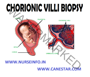 CHORIONIC VILLI BIOPSY - Nurse Info