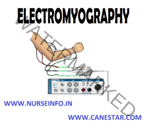 ELECTROMYOGRAPHY - Nurse Info