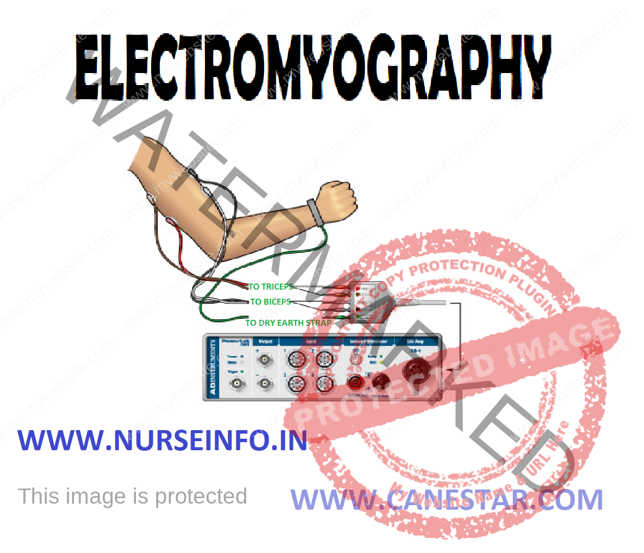 ELECTROMYOGRAPHY - Nurse Info