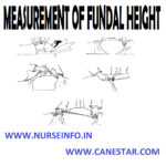 MEASUREMENT OF FUNDAL HEIGHT - Nurse Info
