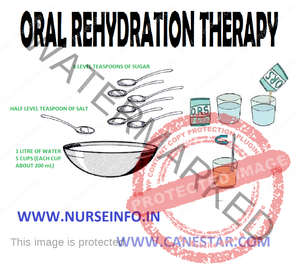 ORAL REHYDRATION THERAPY Nurse Info