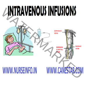 INTRAVENOUS INFUSIONS - Nurse Info