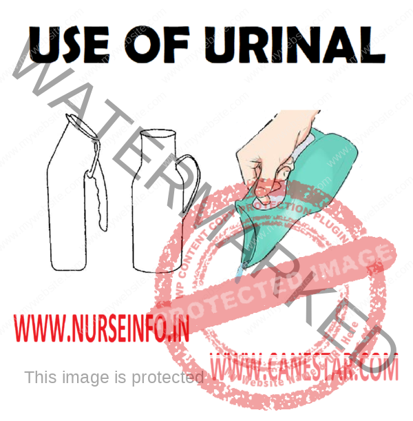 Use of urinal in hospitals - Purpose