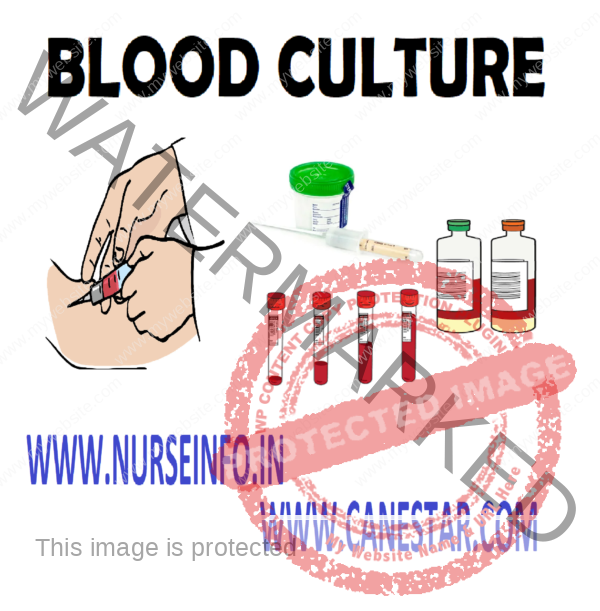 Blood culture Procedure and processing