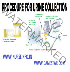 PROCEDURE FOR URINE COLLECTION - Guidelines