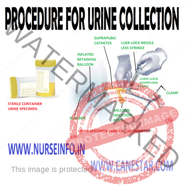 PROCEDURE FOR URINE COLLECTION - Guidelines