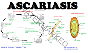 ASCARIASIS – General Characteristics, Life Cycle, Pathogenesis ...