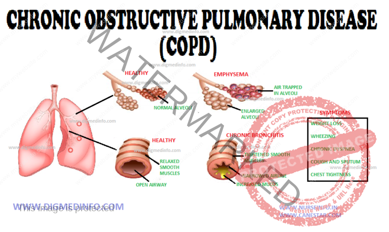 COPD (Chronic Obstructive Pulmonary Disease) CHRONIC BRONCHITIS ...