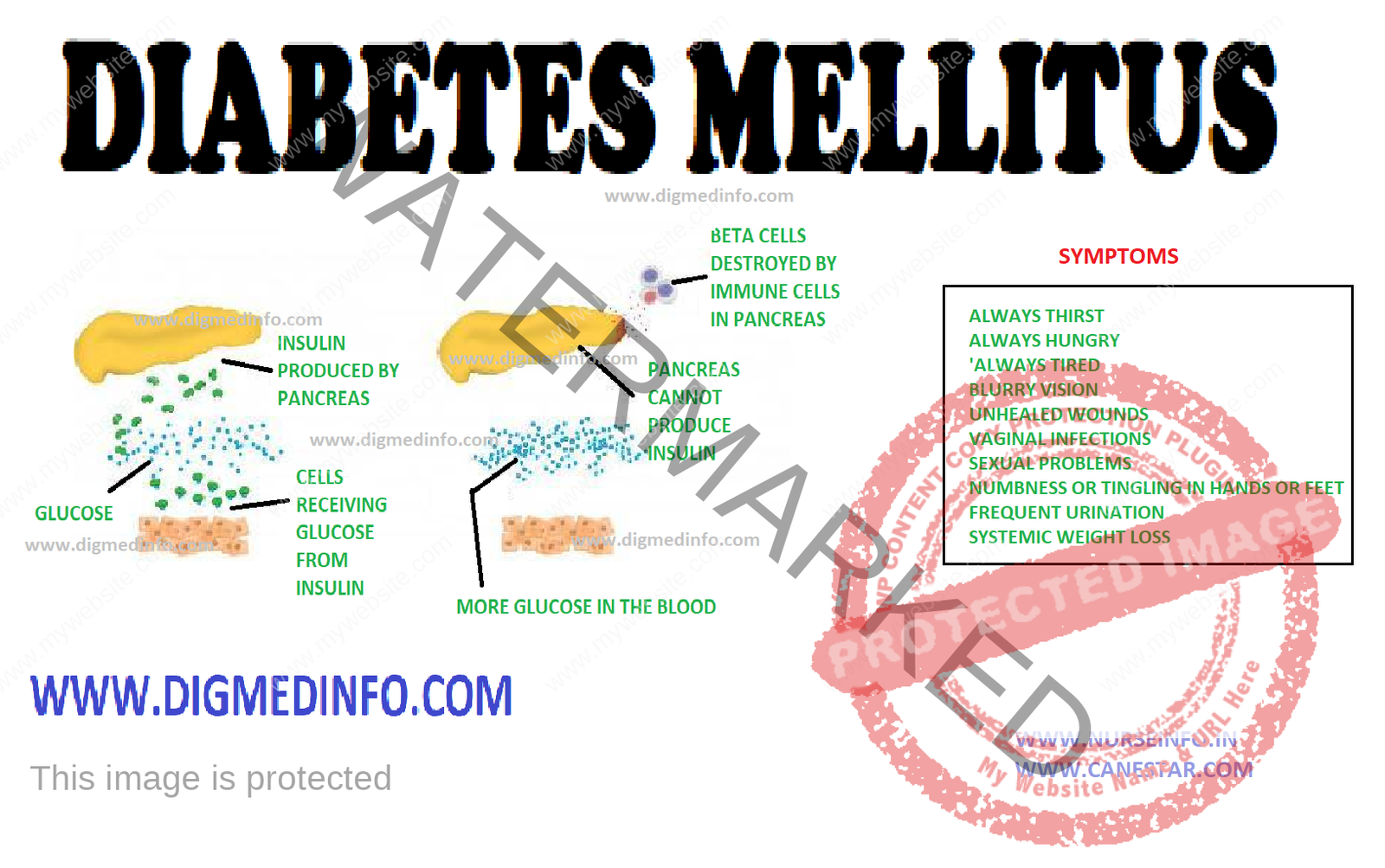 DIABETES MELLITUS – General Characteristics, Pancreas, Classification ...