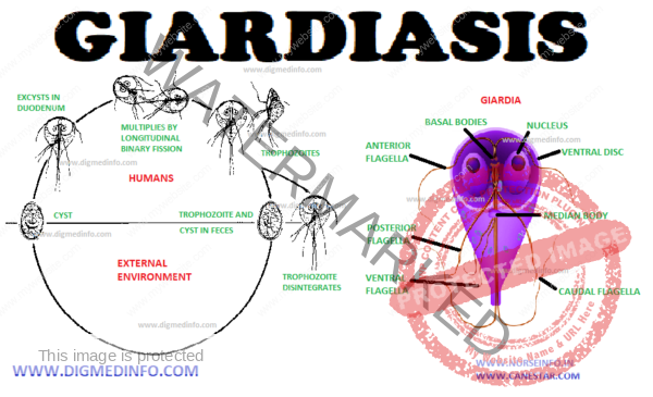 GIARDIASIS - General Characteristics, Transmission, Pathogenesis ...