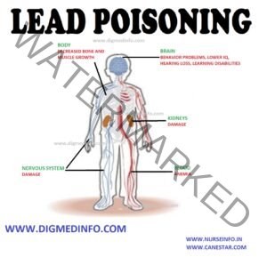 LEAD POISONING – General Features, Treatment, Chronic Lead Poisoning ...